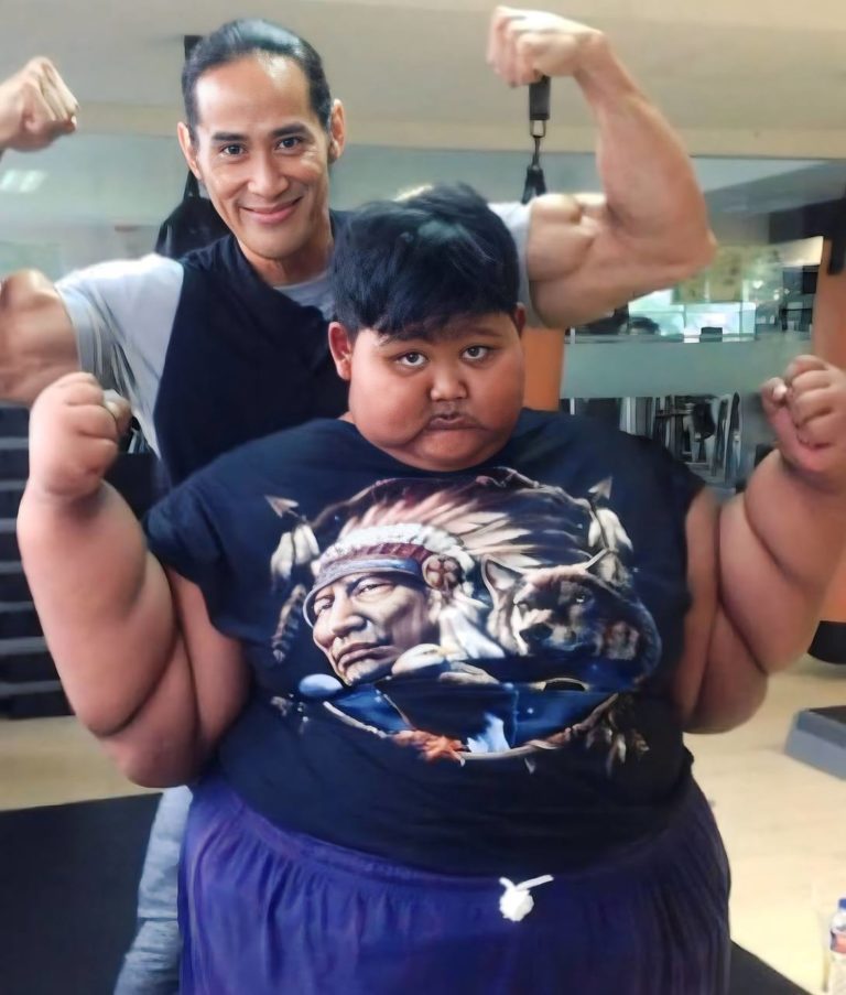 He Was Once Called the World’s Fattest Boy… But Just Look at Him Now