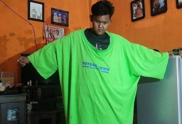 He Was Once Called the World’s Fattest Boy… But Just Look at Him Now