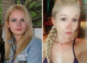 She Says She’s a ‘Natural’ Human Barbie — Then the Old Photos Resurfaced