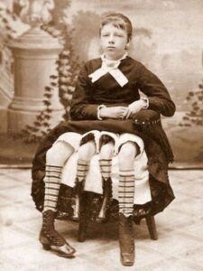 Myrtle Corbin — The Girl With Four Legs Who Found Happiness in Life